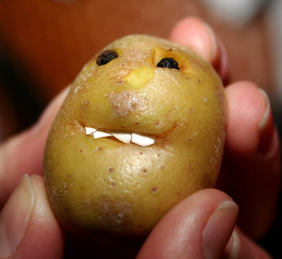 Potato teeth hurt 😢🥺😫😭 | Potato Chips