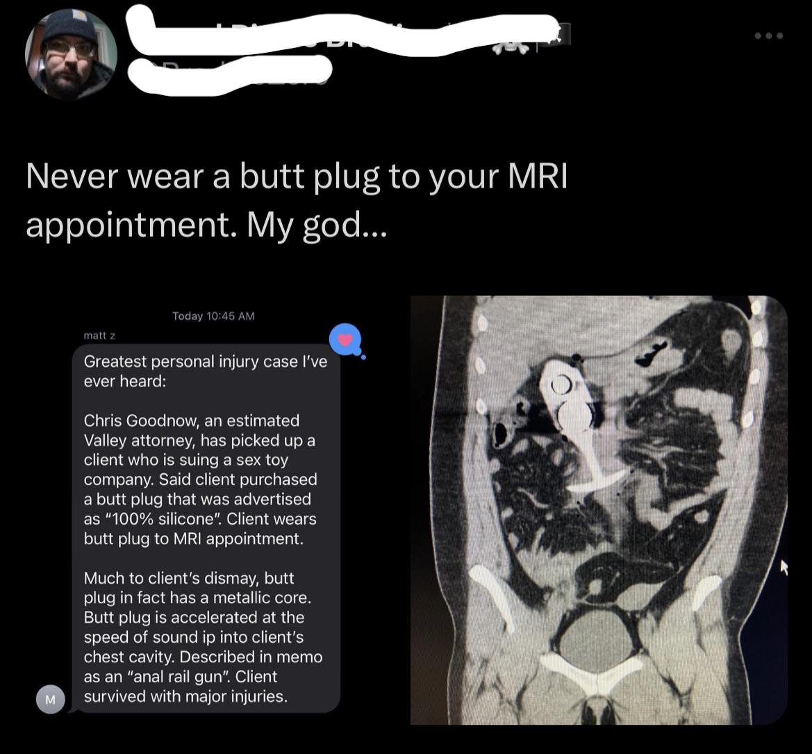 Someone wore a butt plug for an MRI appointment that was supposed to be ...