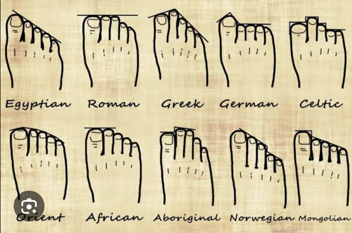 The Greek toe Greek Toe: When the second toe is longer than the big toe ...